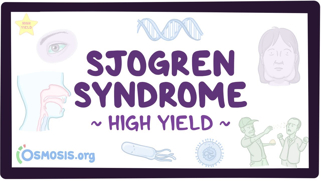 Sjogren syndrome: Pathology review: Video, Causes, & Meaning | Osmosis