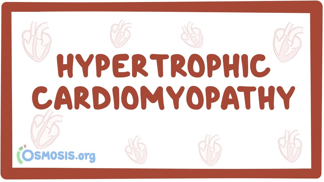 Hypertrophic cardiomyopathy | Osmosis