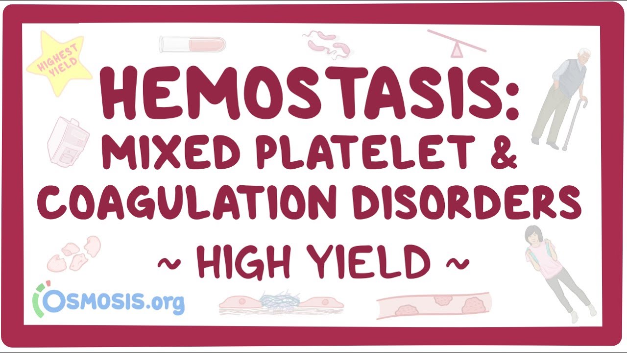 Mixed platelet and coagulation disorders: Pathology review: Video ...