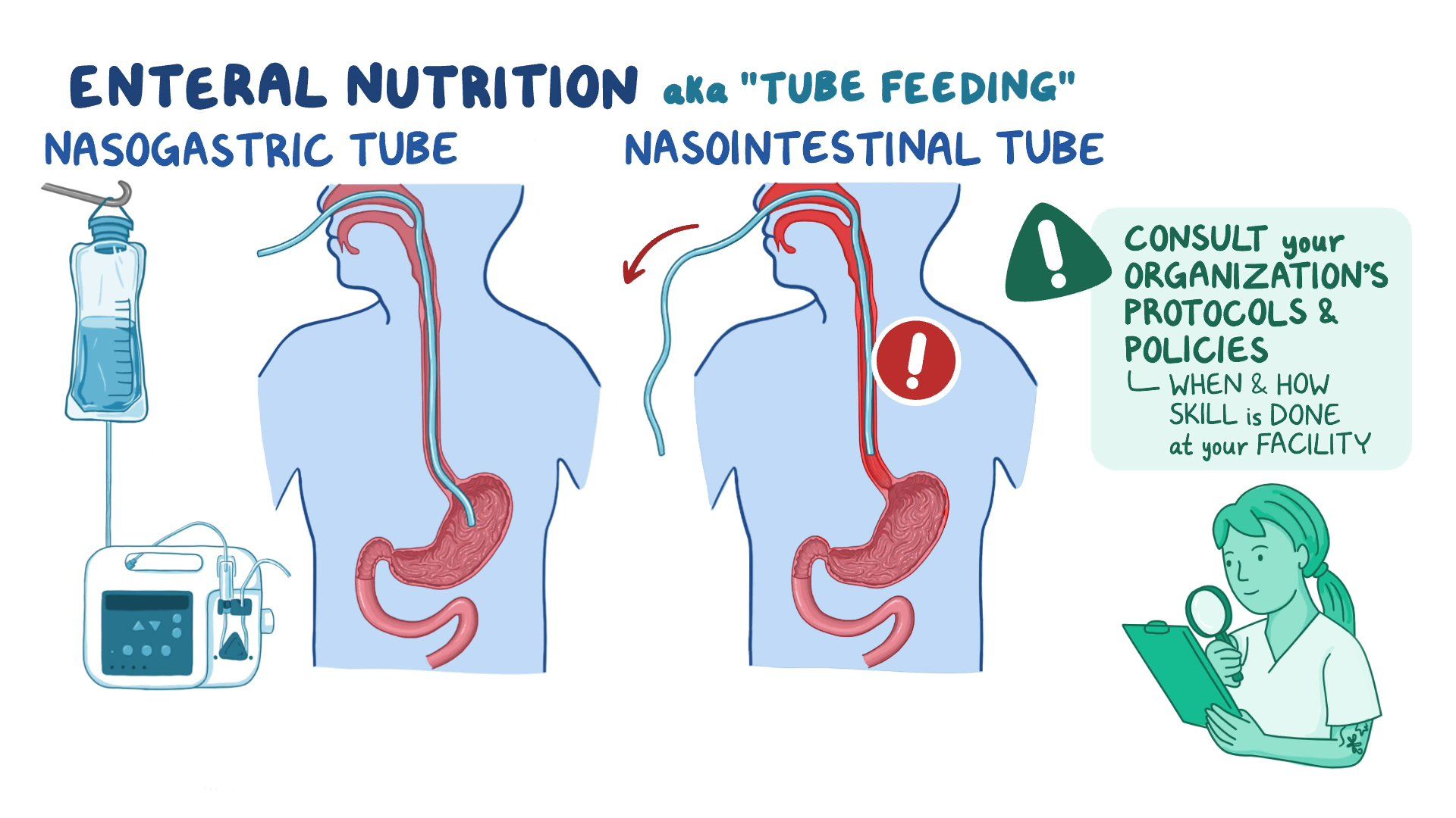 Nursing Care For Enteral Nutrition Osmosis Video Library
