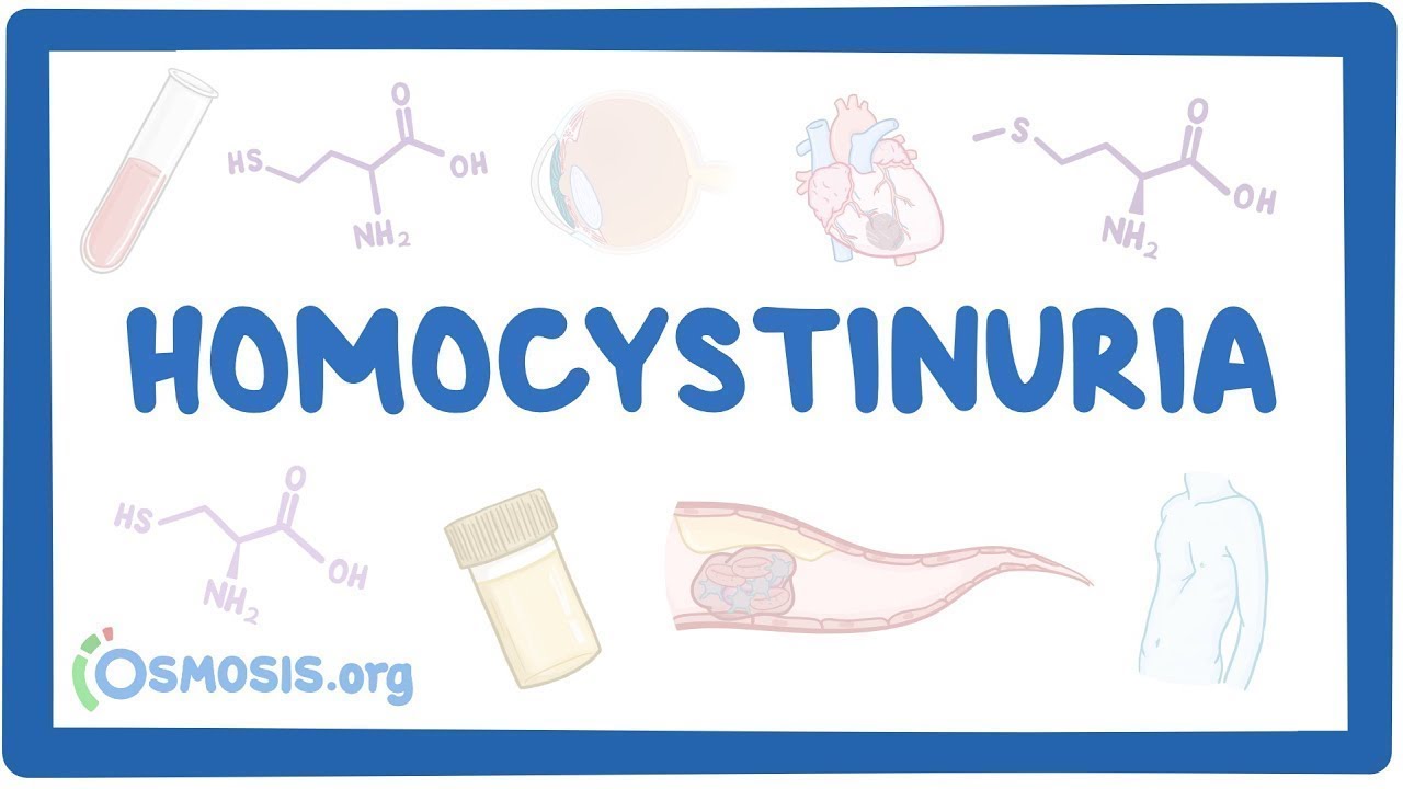 Homocystinuria: Video, Causes, & Meaning | Osmosis