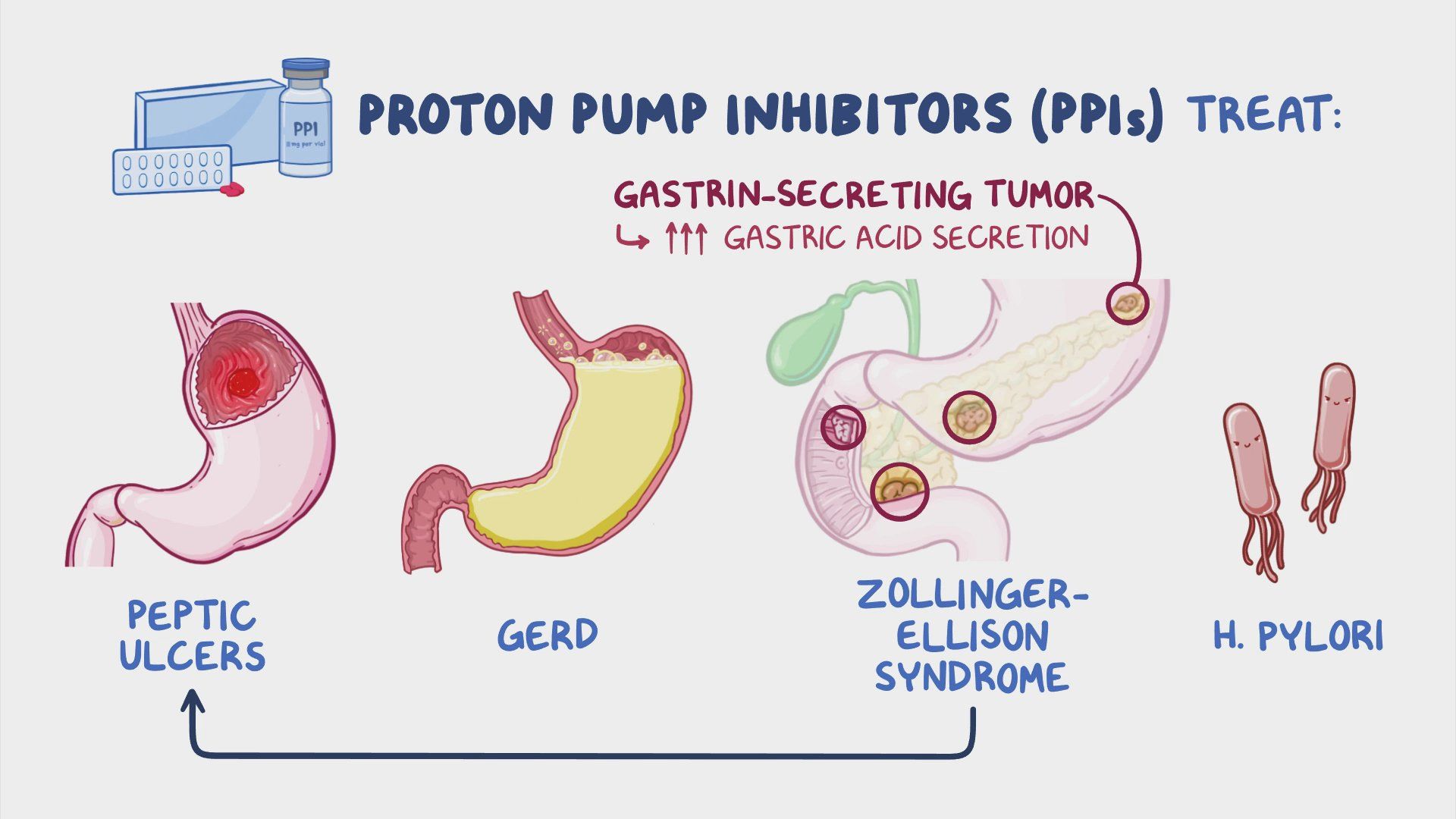 Proton Pump Inhibitors PPIs Nursing Pharmacology Osmosis Video Library