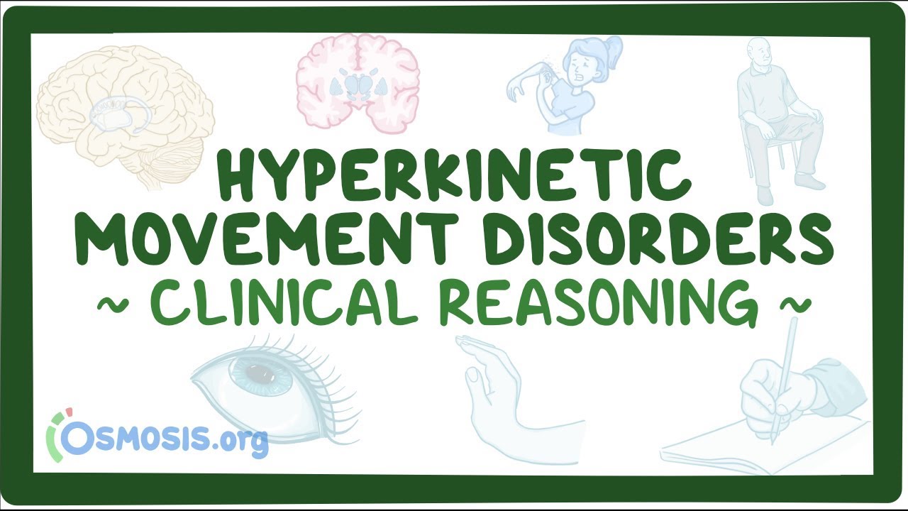 Hyperkinetic movement disorders: Clinical: Video, Causes, & Meaning ...