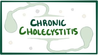 Acute cholecystitis - Osmosis