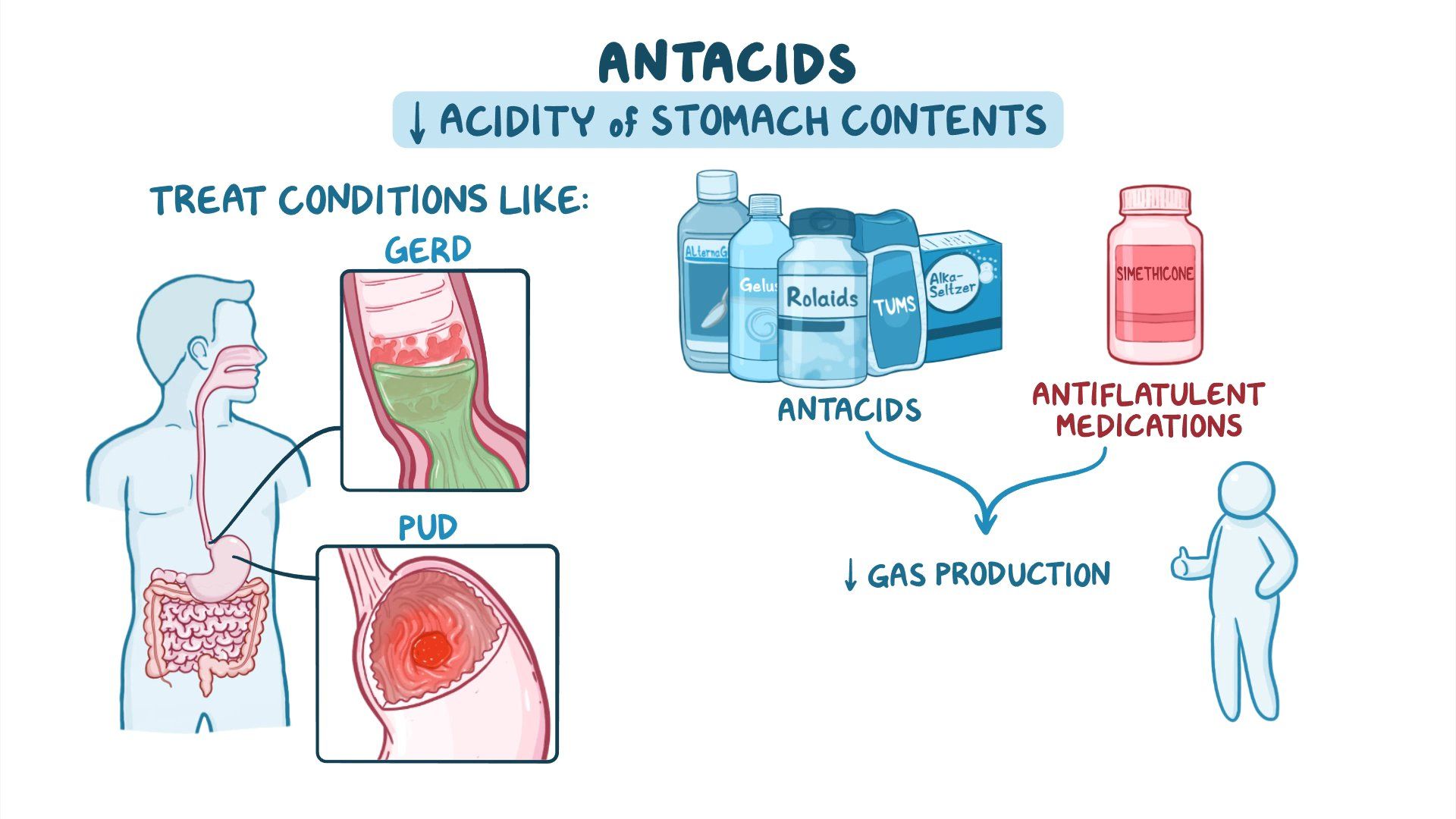 Antacids Nursing Pharmacology Osmosis Video Library Antacids Nursing Pharmacology Osmosis Video Library