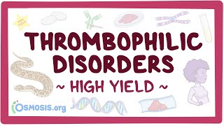 Thrombosis syndromes (hypercoagulability): Pathology review: Video ...