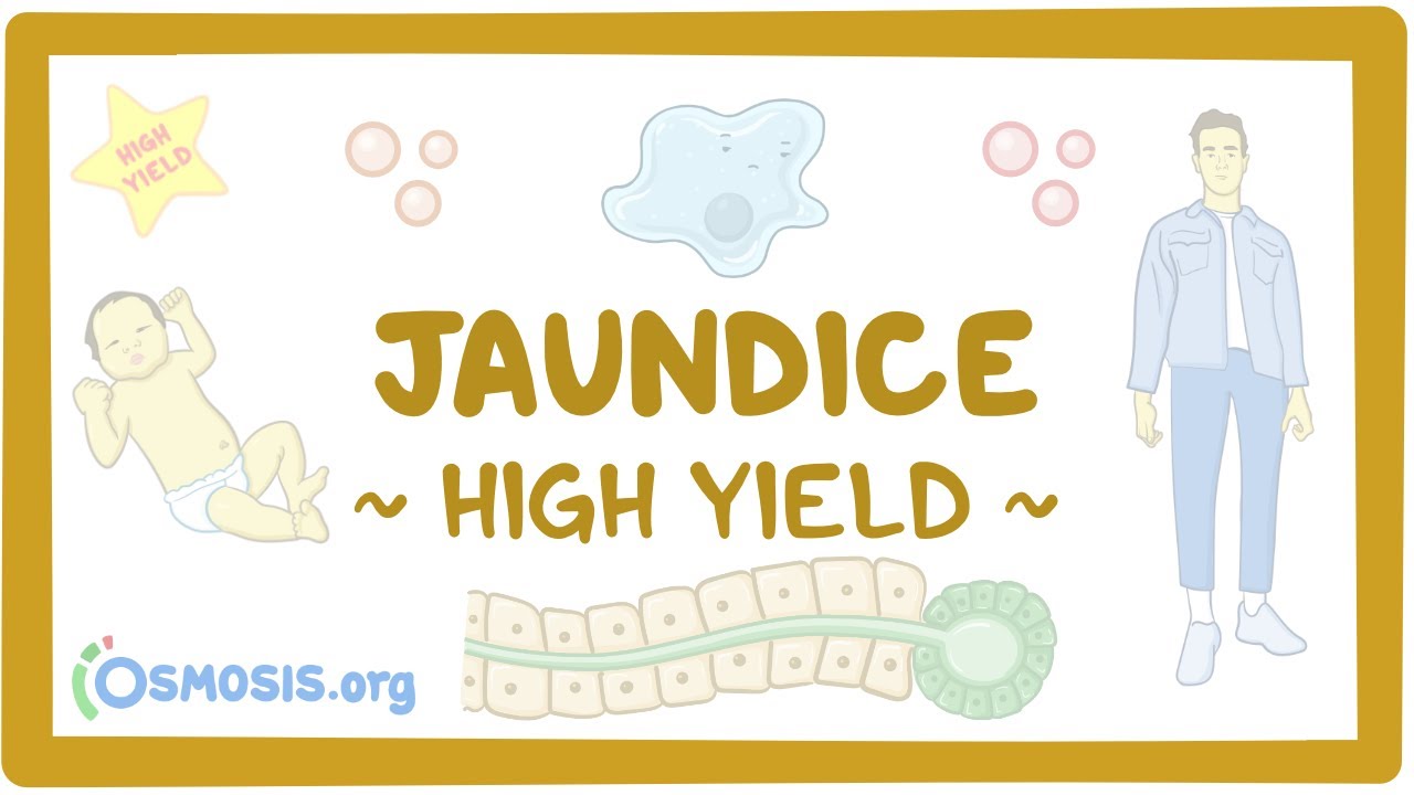 Jaundice: Pathology review: Video, Causes, & Meaning | Osmosis