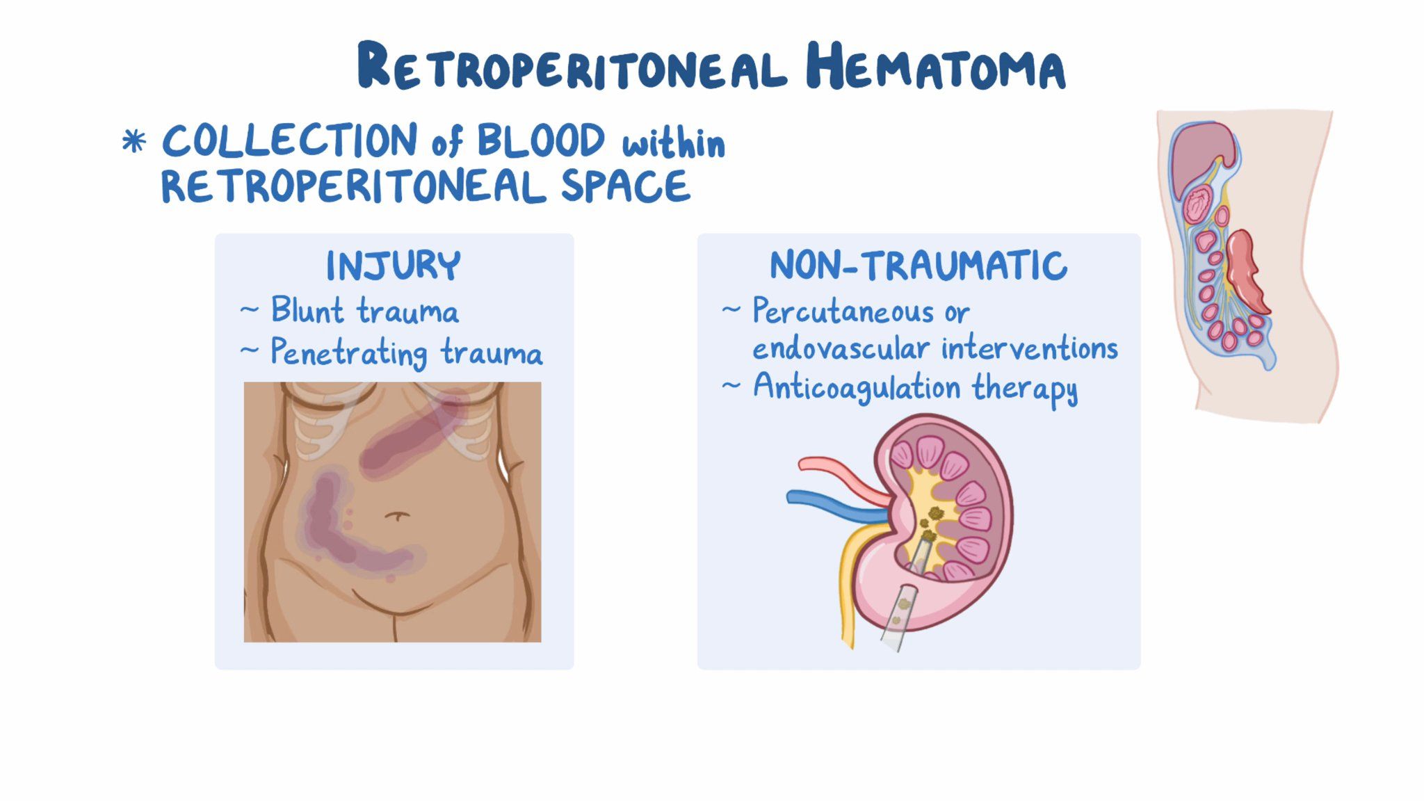 Retroperitoneal Retroperitoneal